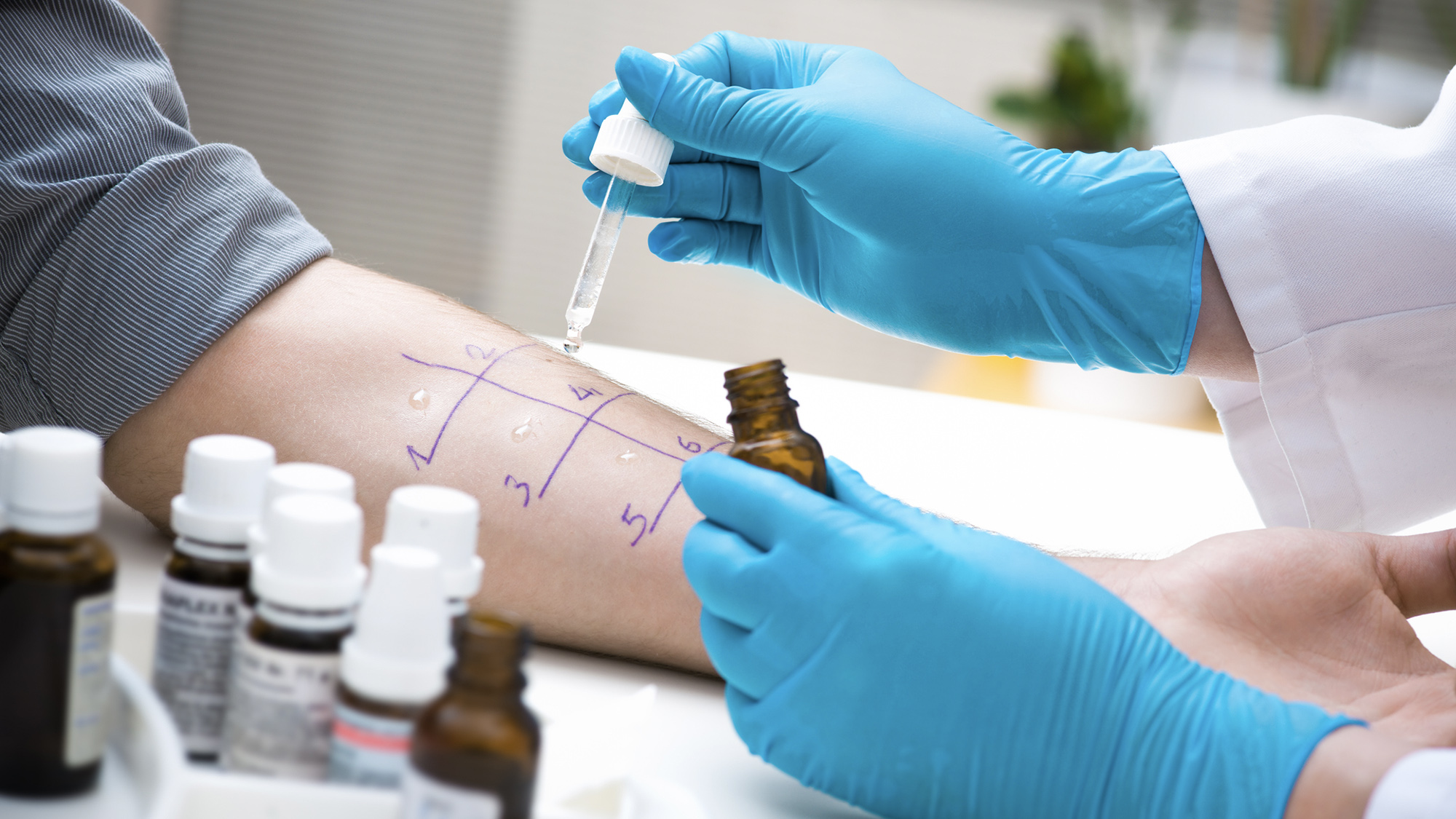 Allergology - Centrul Medical Galenus